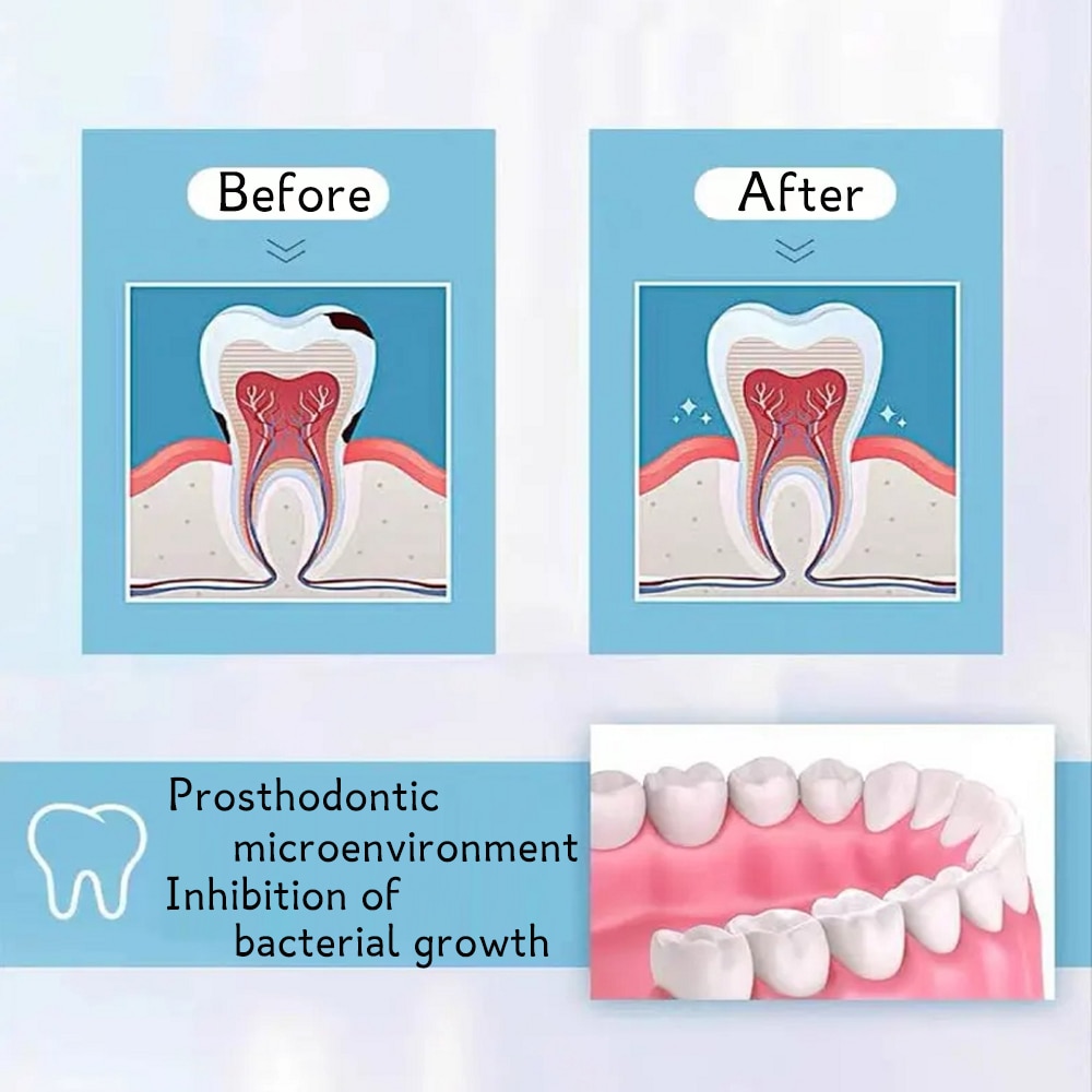 Tooth Sprays – My Blog